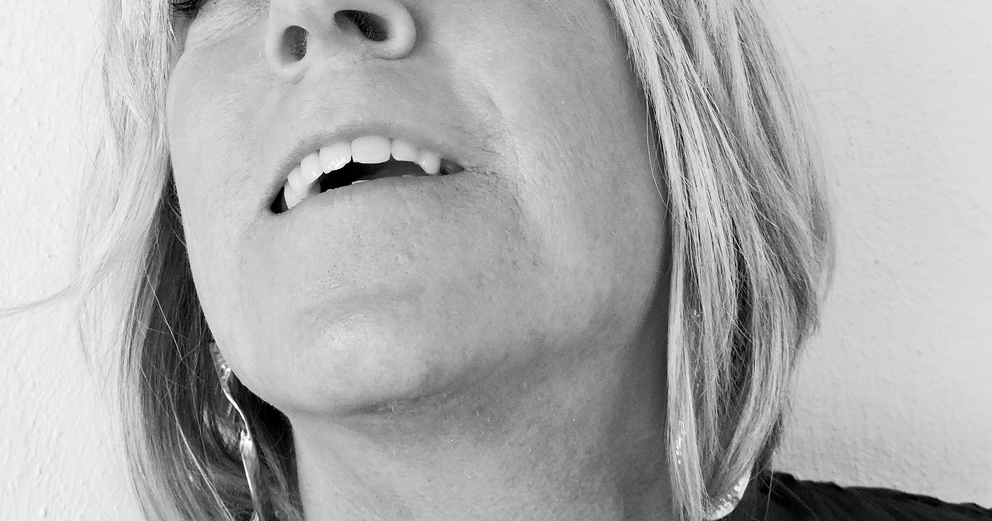 Trans surgery nightmares revealed: 81% endure pain, 33% incontinent ...