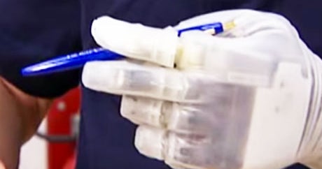 DEKA Arm, Bionic Prosthesis - Amputees, Luke Arm