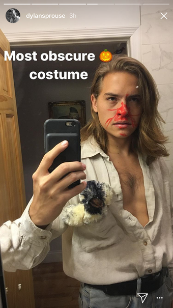 Dylan Sprouse Bloody Nose Costume Explained, Fabio