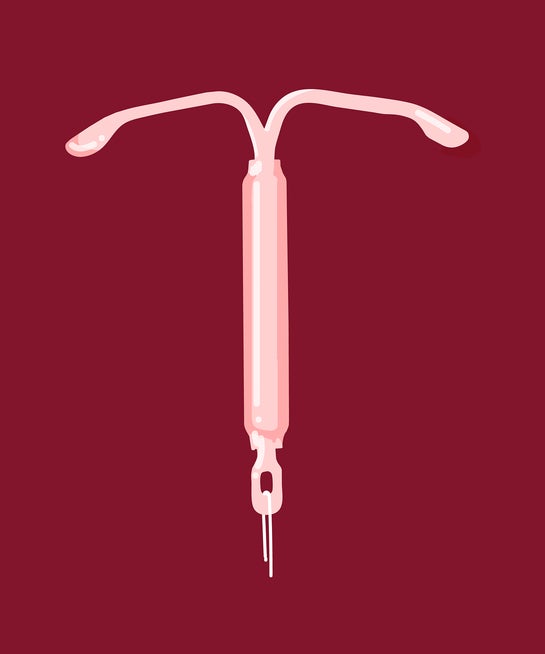 Iud Birth Control