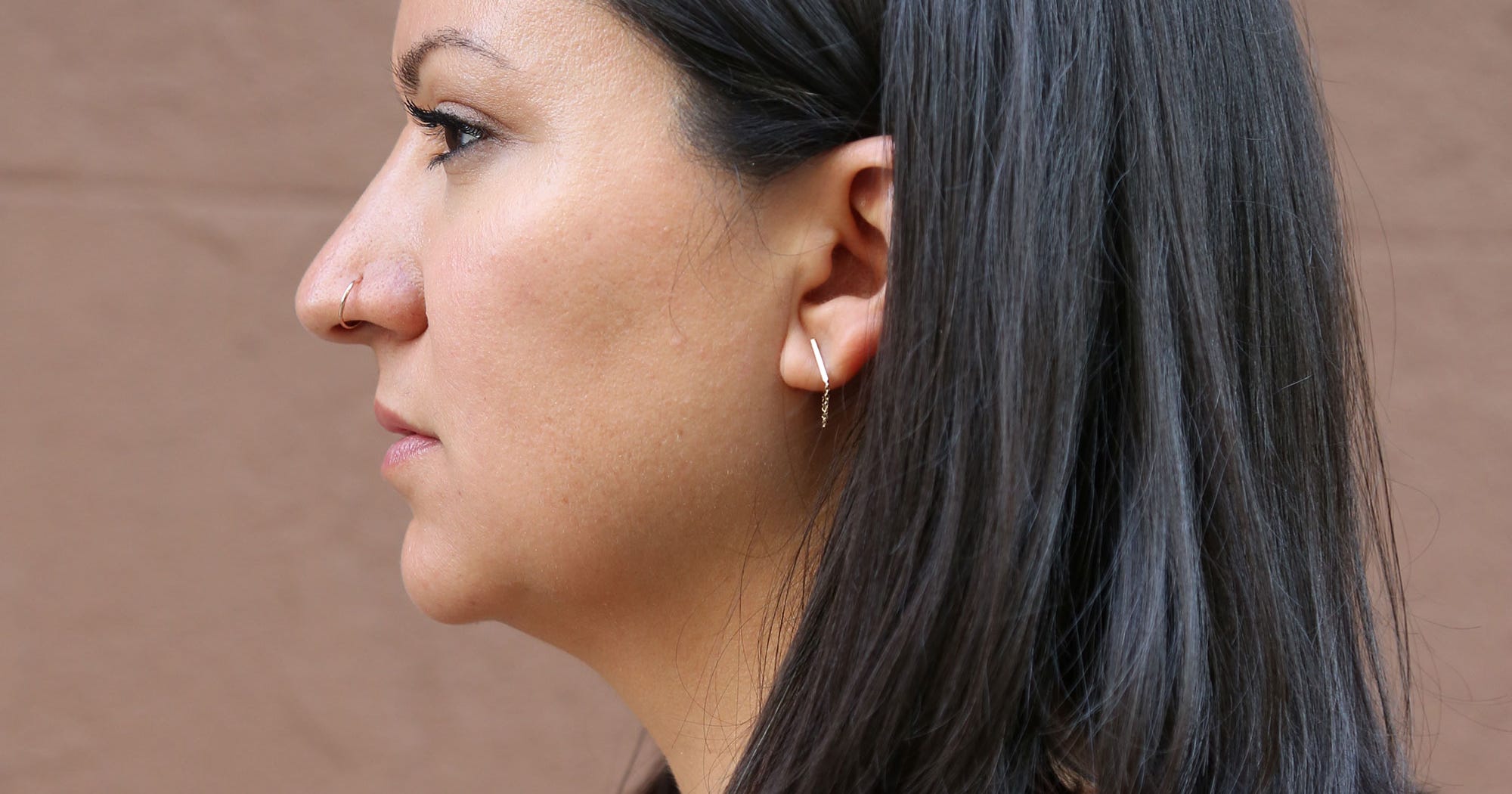 Kybella Double Chin Removal Treatment Injection Video