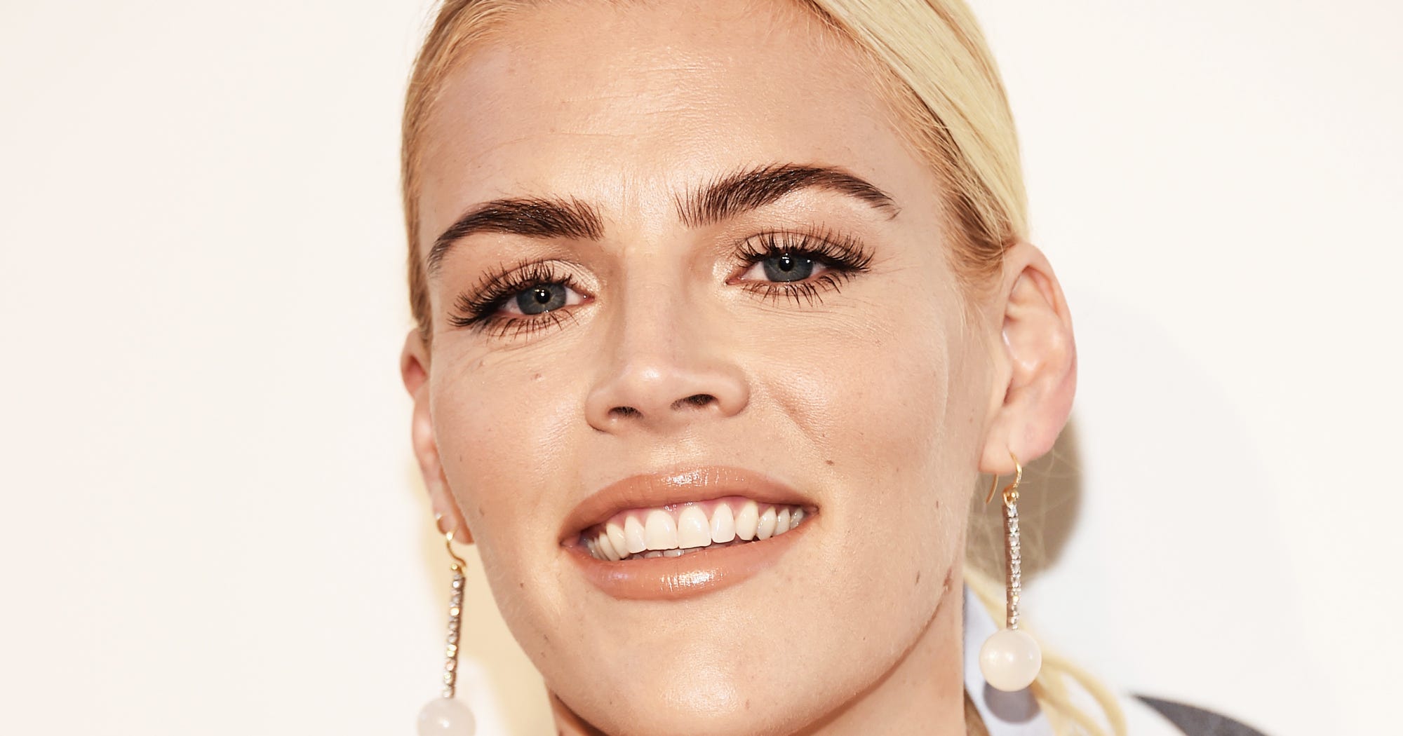 What Is Photokeratisis, Busy Phillips Eye Sunburn Risks