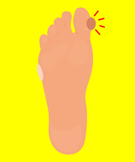 Gross Feet Hygiene Beauty Solutions