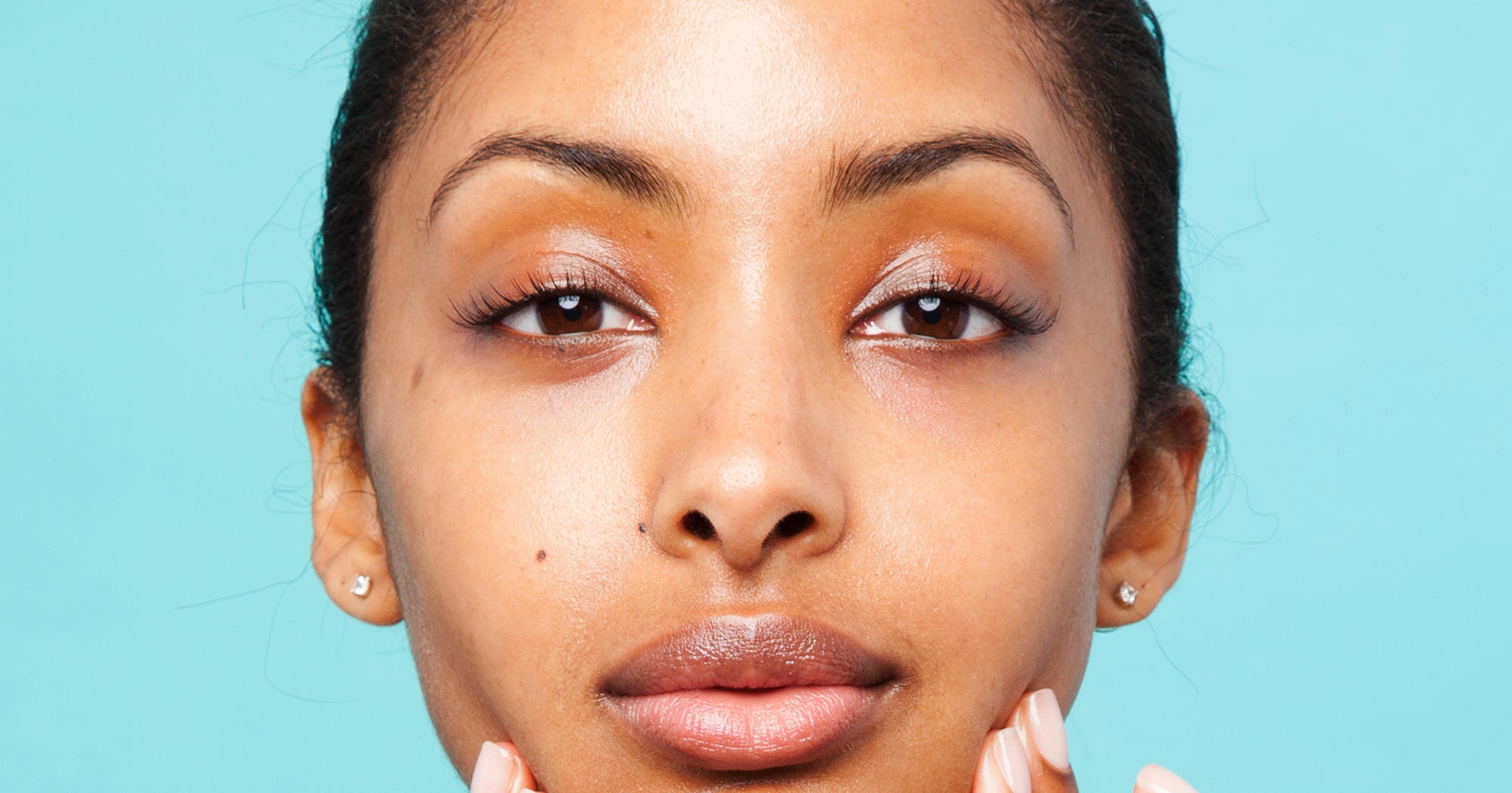 Kitava Island People Diet Skin No Acne Study Nutrition