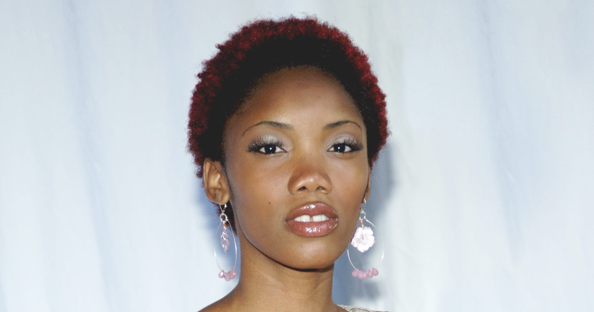 ANTM Brandy Rusher Injured Shootout Critical Condition
