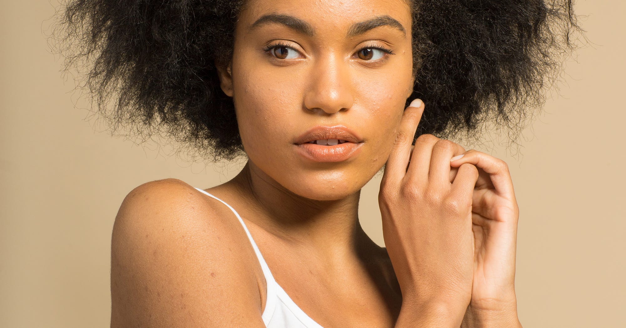 Difference Between Acne Breakouts And Skin Purging