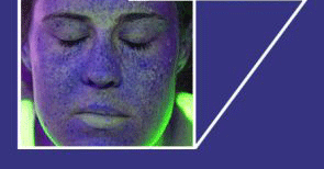 Skin Damage - UV Portraits - UV