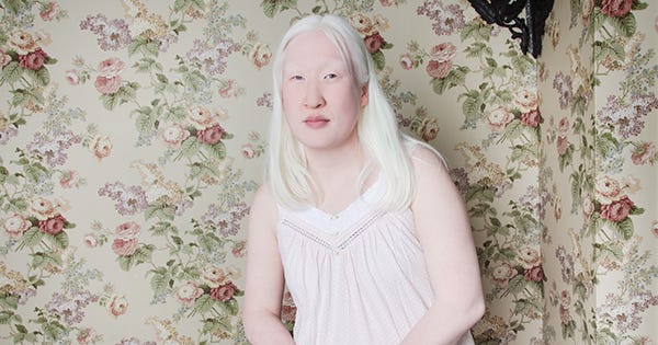 Albino People Photos Albinism Portraits