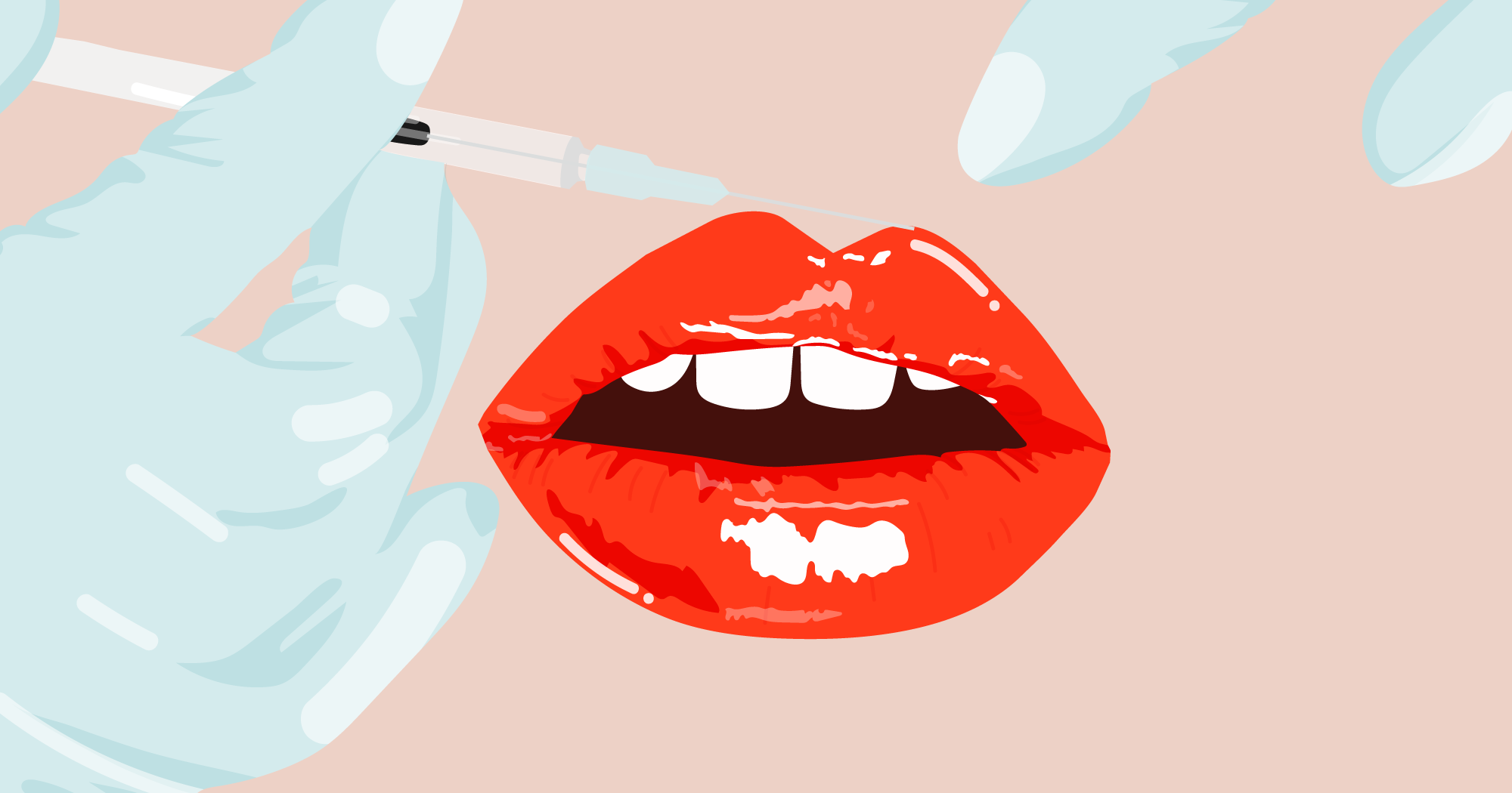 Lip Anatomy Diagram Injections