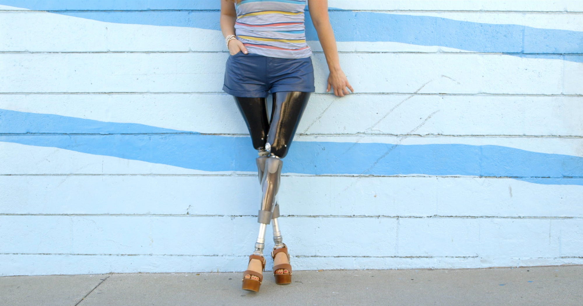 Disabled Actress, Comedian Katy Sullivan Legs TV Series